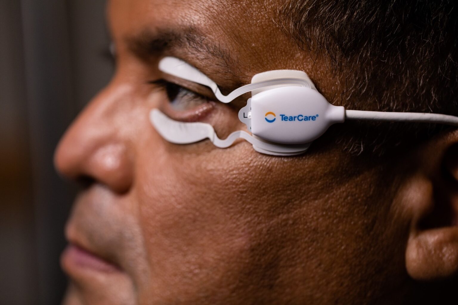 TearCare® | Goodman Eye Center